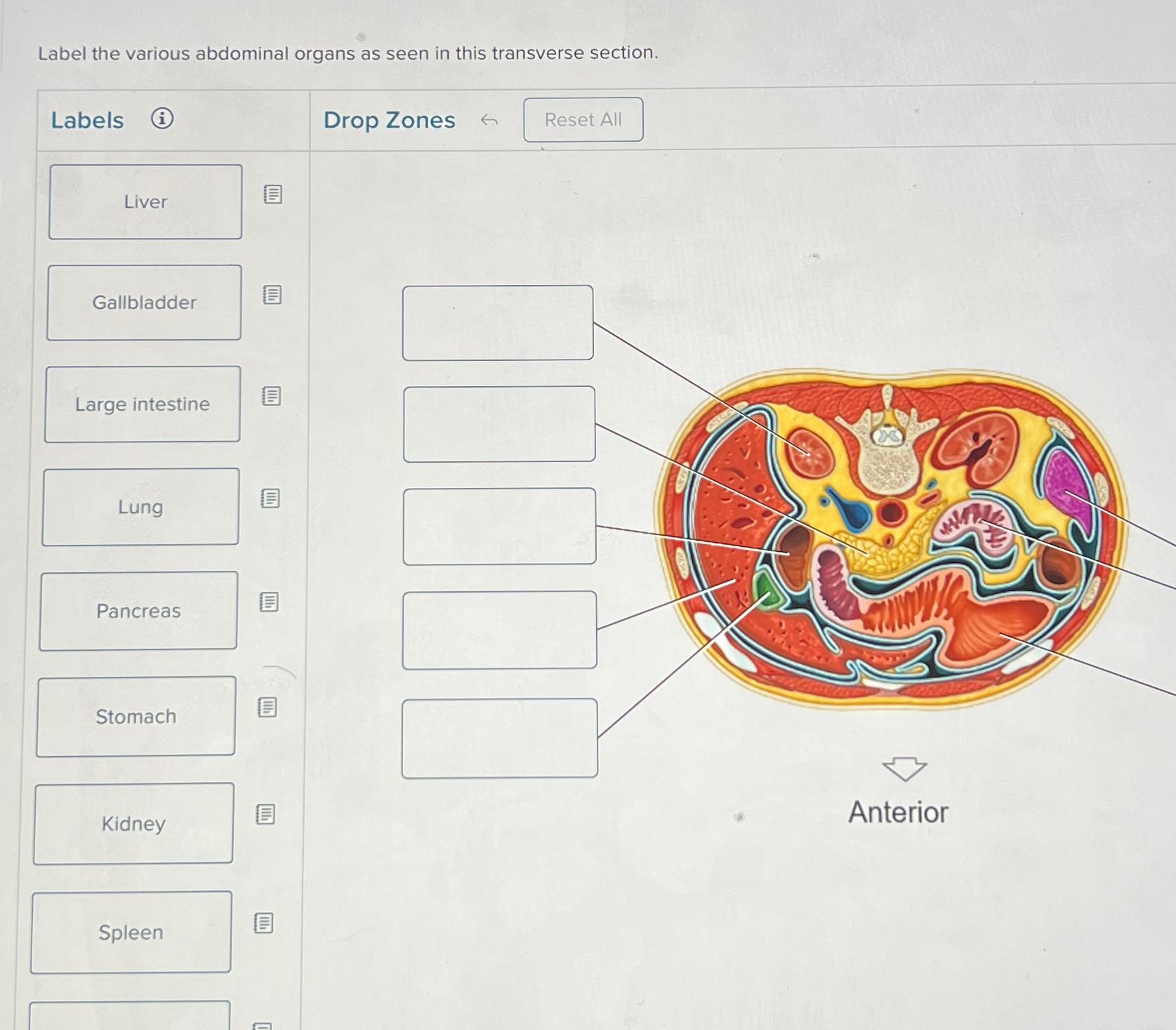 Solved Label the various abdominal organs as seen in this | Chegg.com