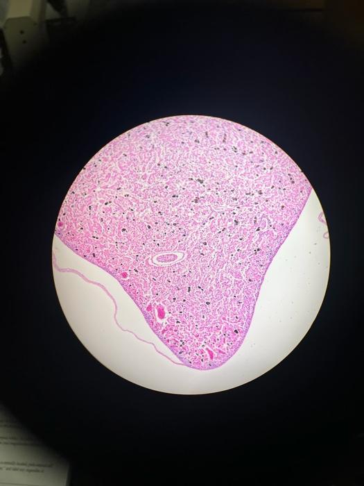 Solved Oral smear This slide features human cheek cells, | Chegg.com