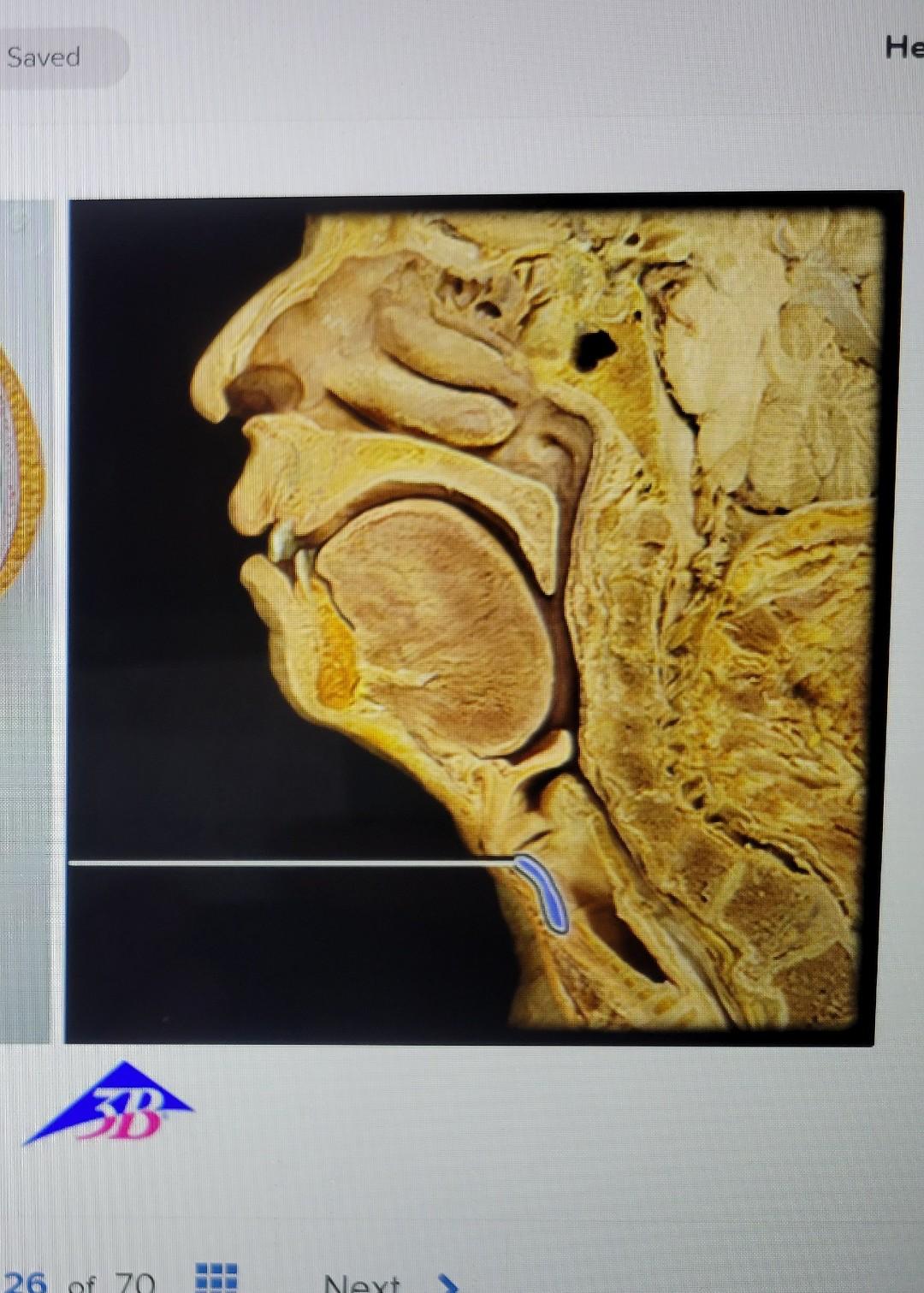 Solved Exam Which strusture is hiahliahted?Cumulative Final | Chegg.com