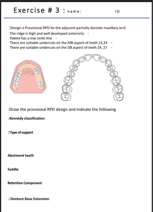 Exercise # 3 : name: ID Design a Provisional RPD for | Chegg.com