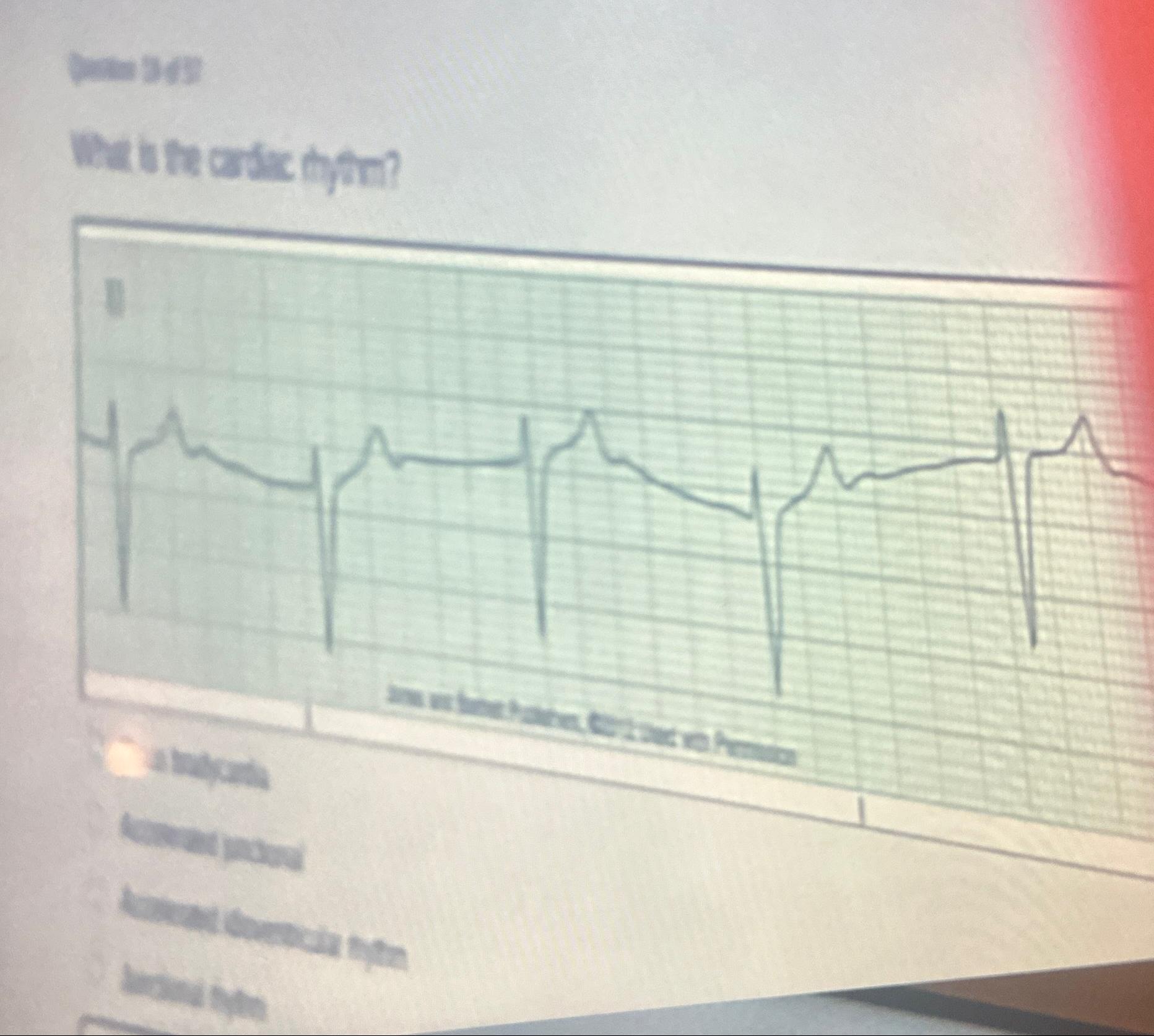 Solved What is the cardiac rhythm ?sinus bradycardia | Chegg.com