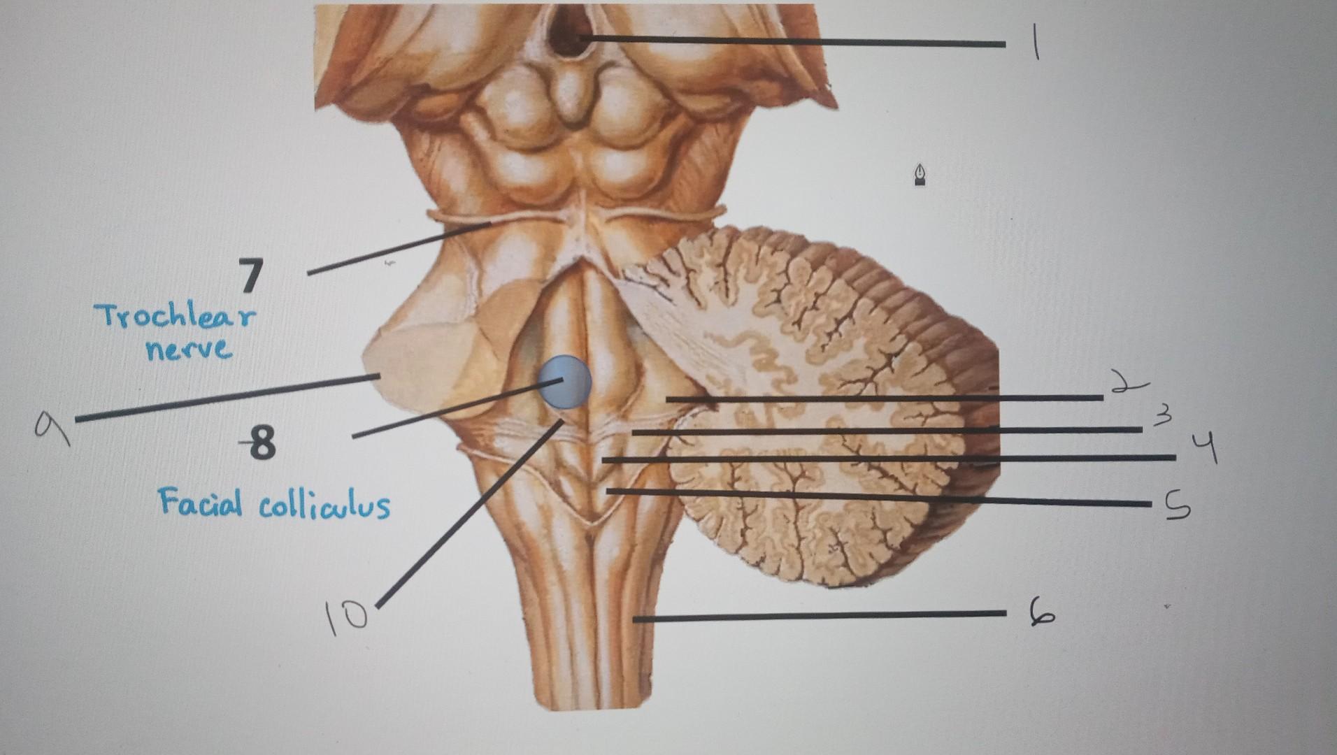 Solved Please label the structures pointed by all the black | Chegg.com