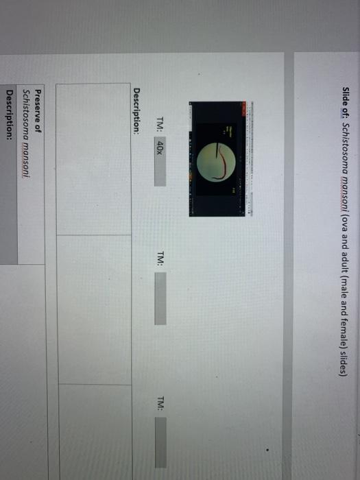 Solved Slide of: Clonorchis sinensis (ova and adult slides) | Chegg.com