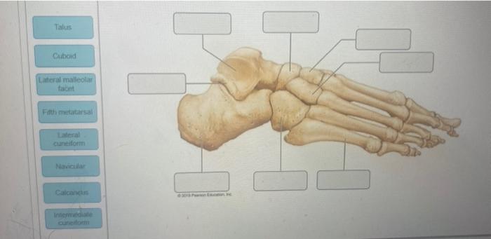 Solved Talus Cubad Lateral malleole cuneiform Calcanas | Chegg.com