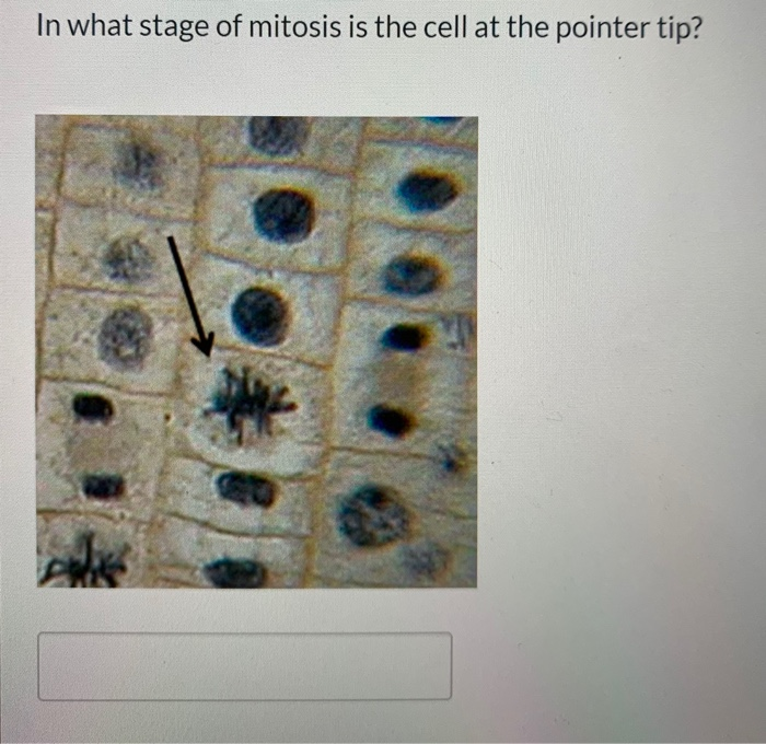 Solved In what stage of mitosis is the cell at the pointer | Chegg.com