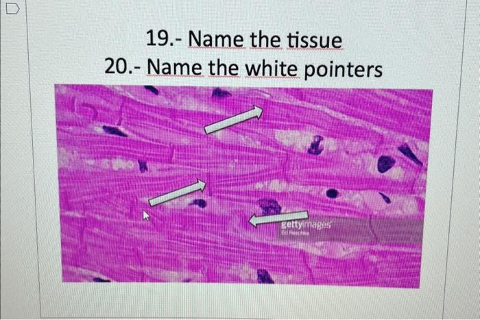 Solved 19.- Name the tissue 20.- Name the white | Chegg.com