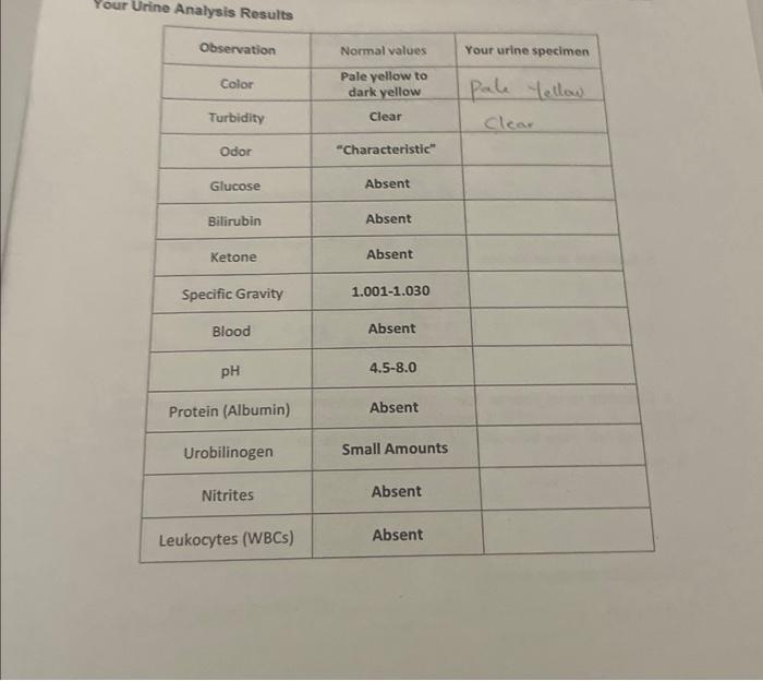 Solved Urine Analysis Results \begin{tabular}{|c|c|c|} | Chegg.com