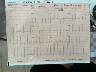 Solved 1. ﻿Is the rhythm regular or irregular?2. ﻿Determine | Chegg.com