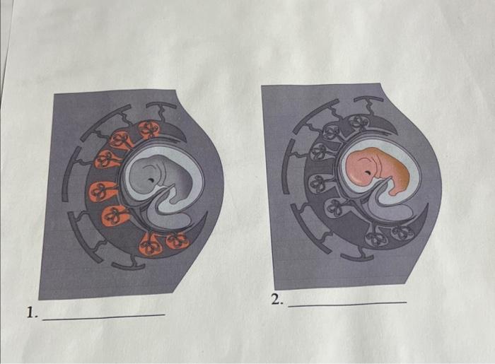 Solved NEURULA STAGE - LATE 1. 1. 2. | Chegg.com