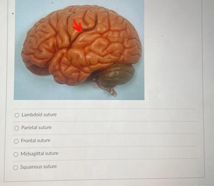 Solved Lambdoid suture Parietal suture Frontal suture | Chegg.com