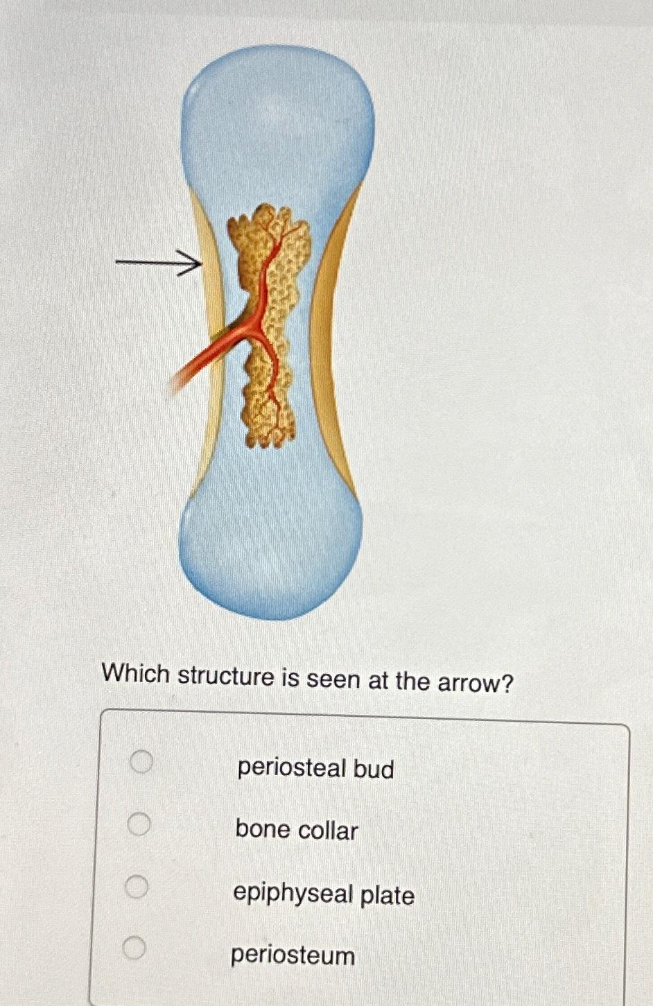 Solved Which structure is seen at the arrow?periosteal | Chegg.com