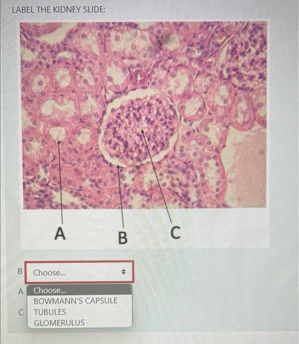Solved LABEL THE KIDNEY SLIDE: А. B C B Choose... > A | Chegg.com