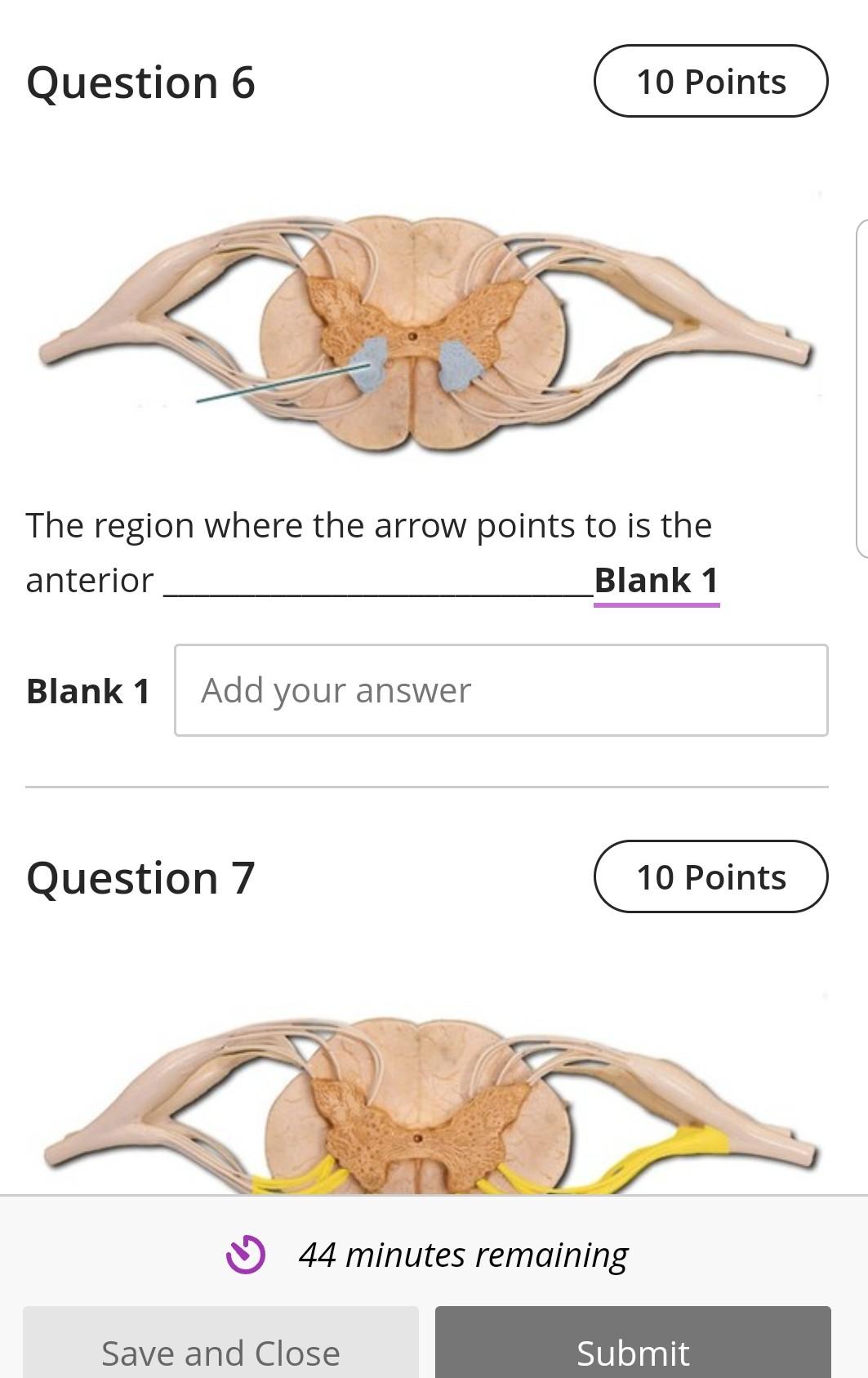 Solved Question 6 10 Points The region where the arrow | Chegg.com Solved Question 6 10 Points The region where the arrow | Chegg.com