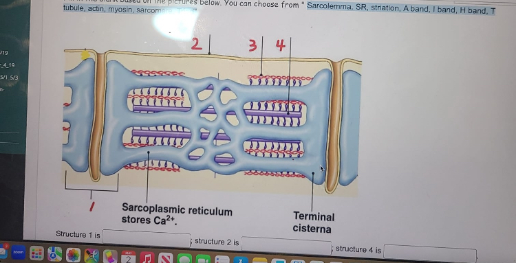 Solved tubule, actin, myosin, sarcomStructure 1 ﻿isstructure | Chegg.com