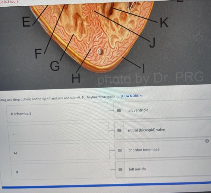 Solved Due in 3 hours A -N В. C -М D EX K J ue in 3 hours | Chegg.com
