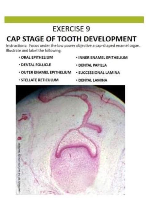 Solved EXERCISE 9 CAP STAGE OF TOOTH DEVELOPMENT | Chegg.com