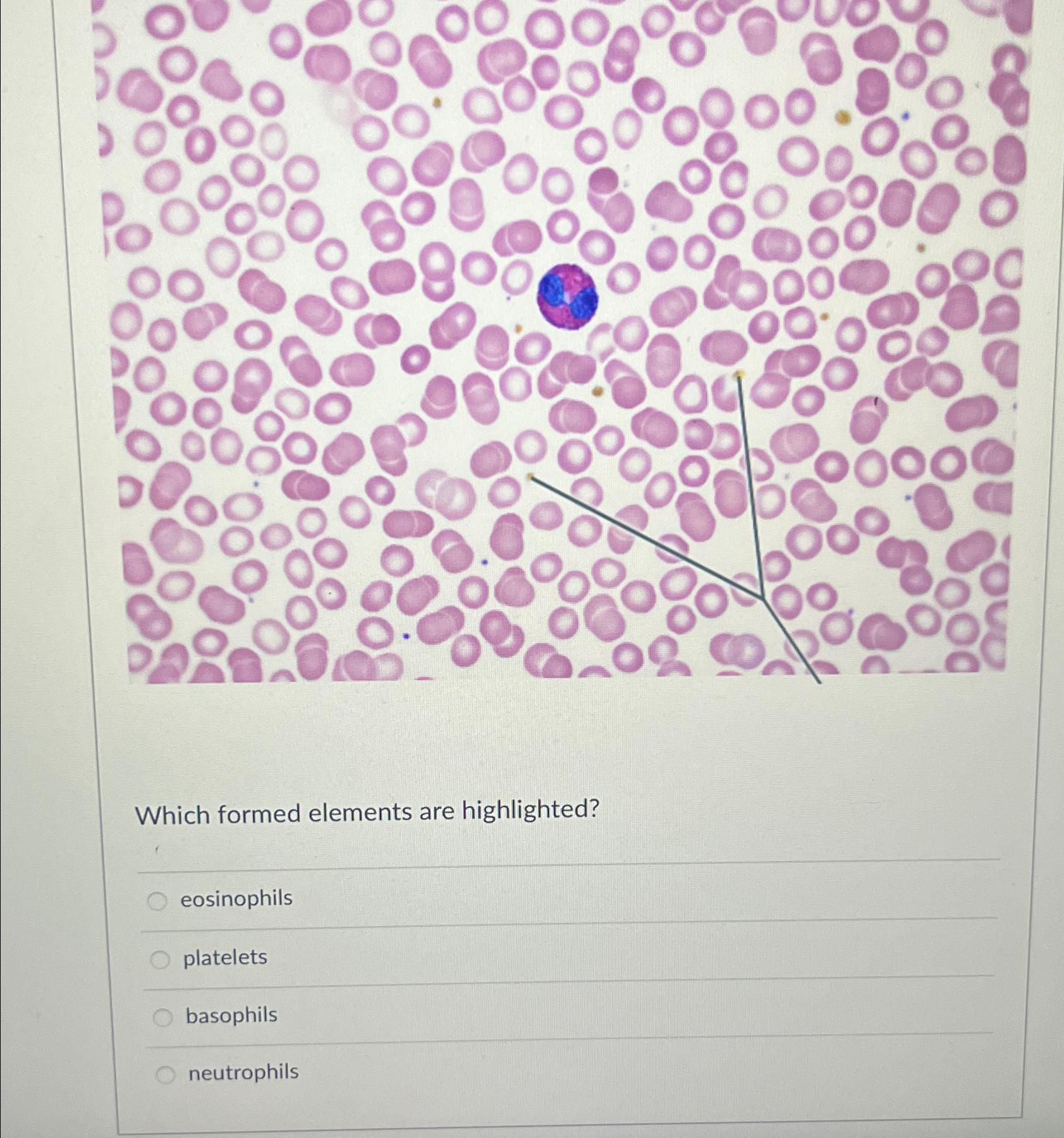 Solved Which formed elements are | Chegg.com
