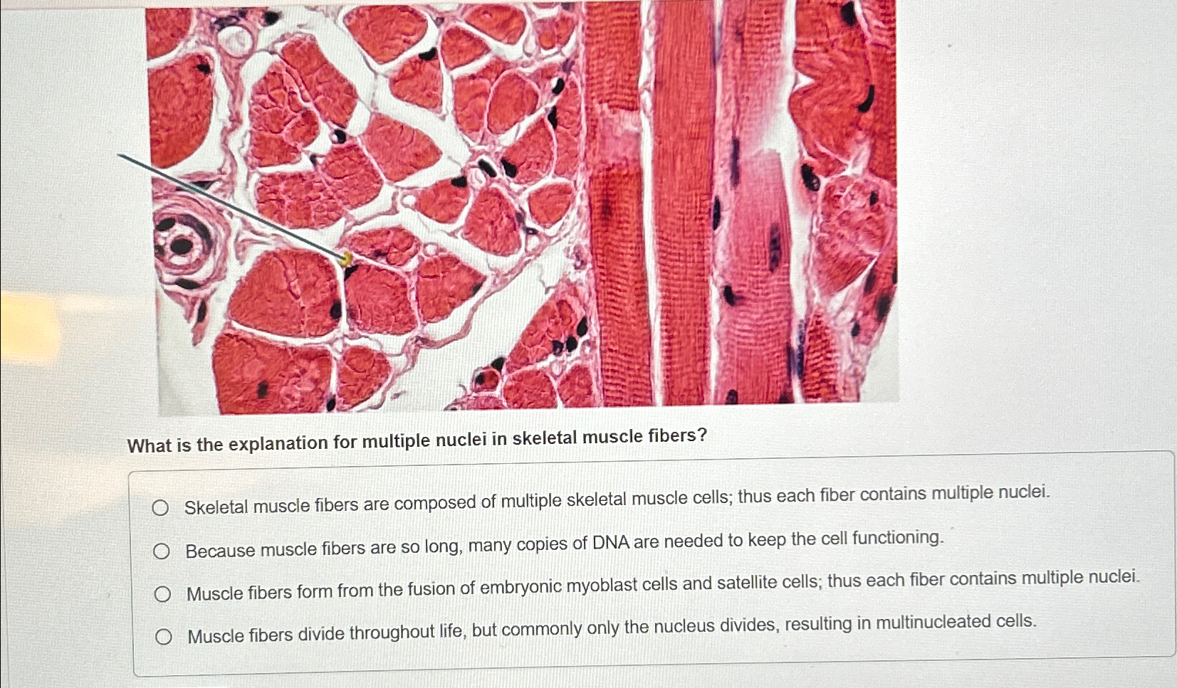 What is the explanation for multiple nuclei in | Chegg.com
