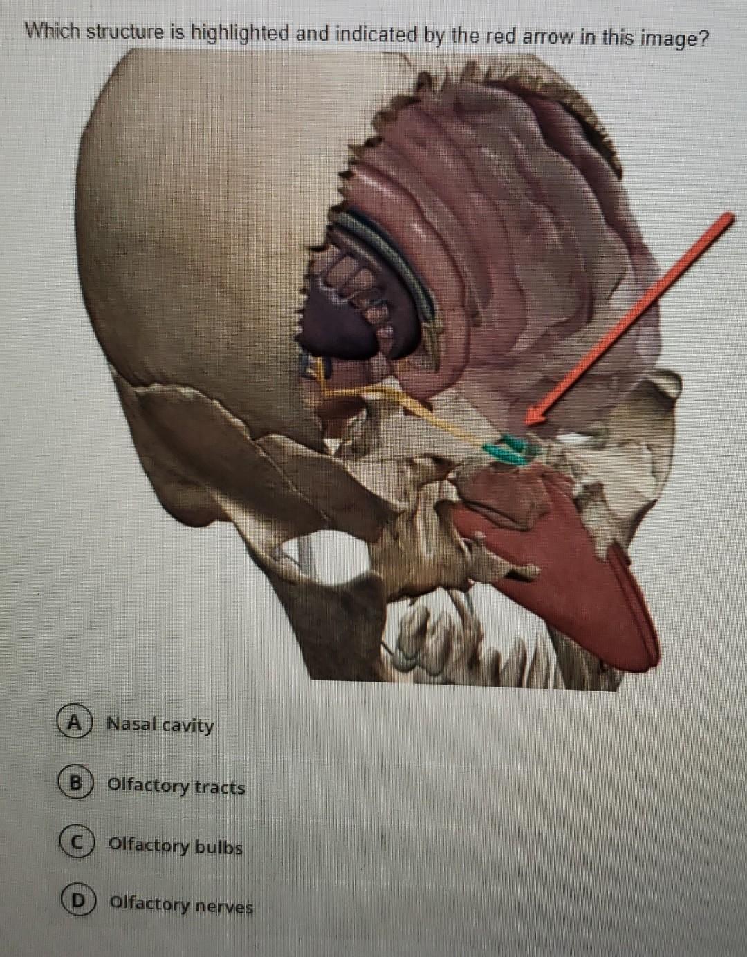 Solved Which structure is highlighted and indicated by the | Chegg.com