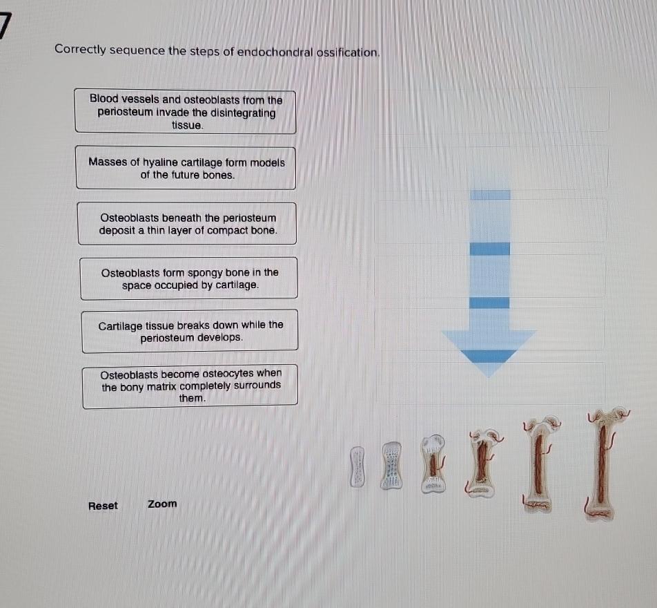 Solved Correctly sequence the steps of endochondral | Chegg.com Solved Correctly sequence the steps of endochondral | Chegg.com