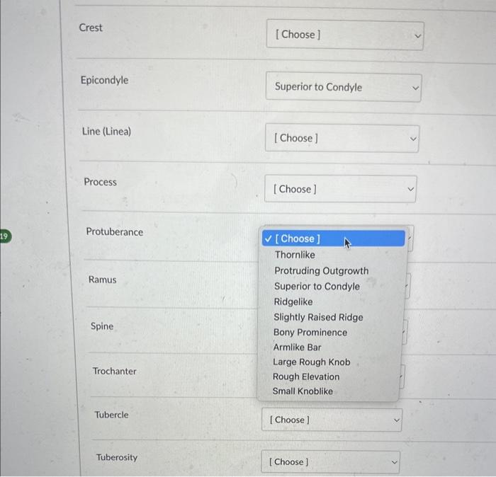 Solved Crest Epicondyle Line (Linea) Process Protuberance | Chegg.com
