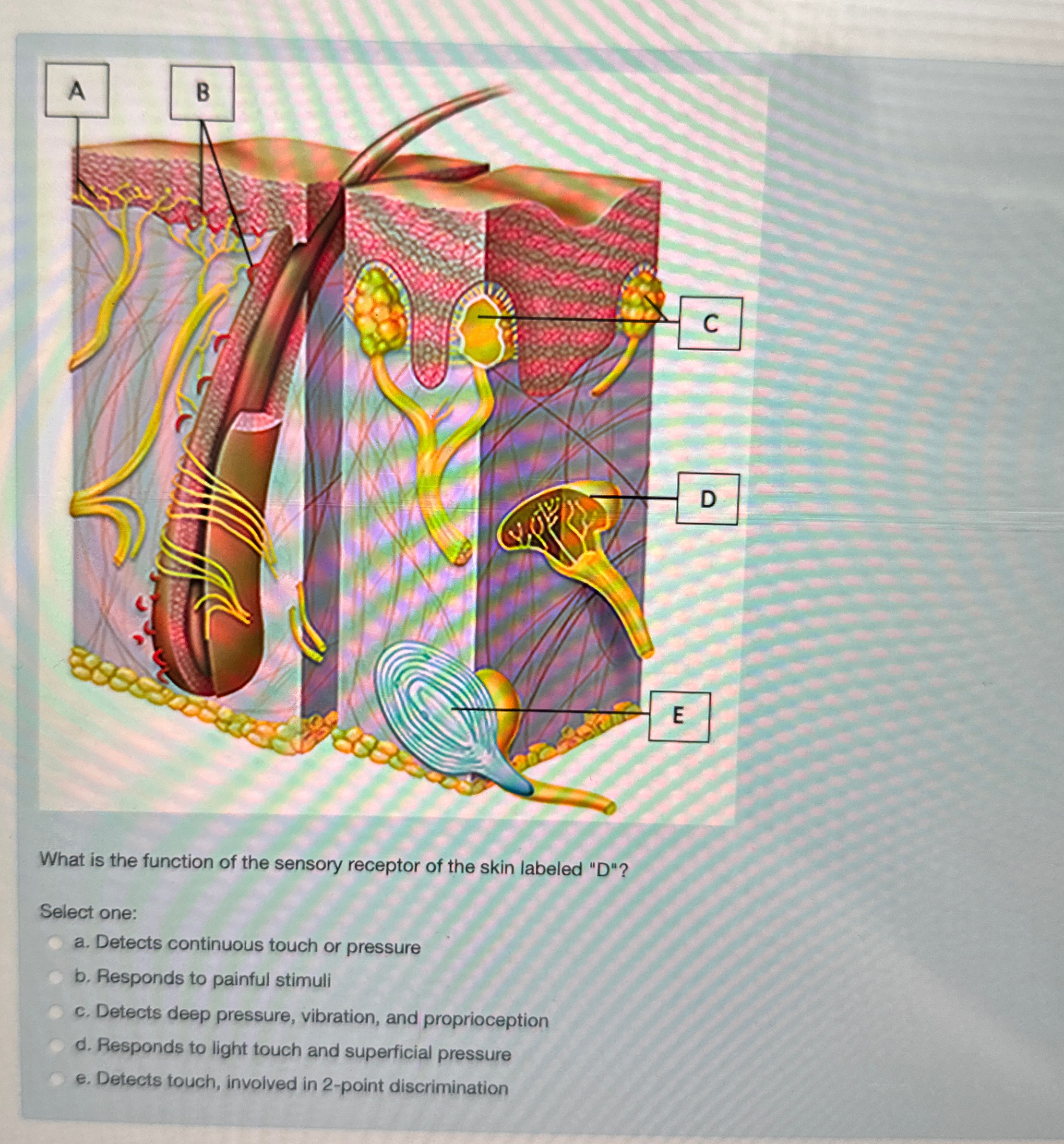 Solved What is the function of the sensory receptor of the | Chegg.com