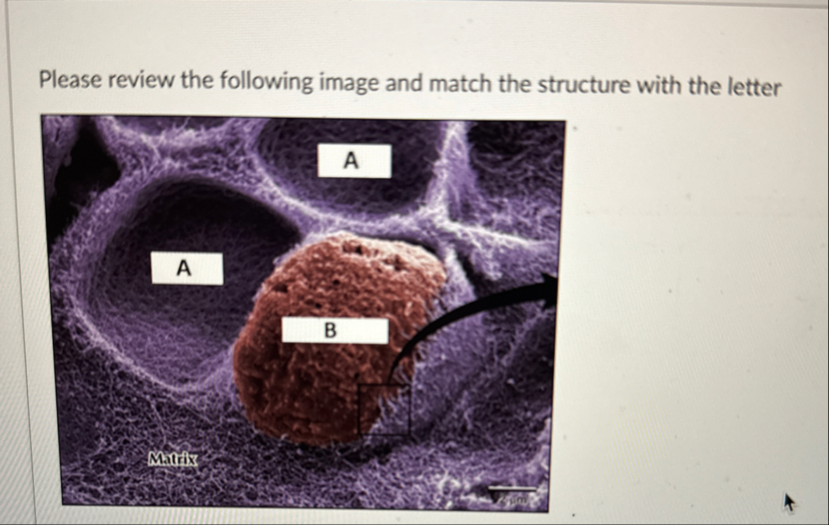 Solved Please review the following image and match the | Chegg.com