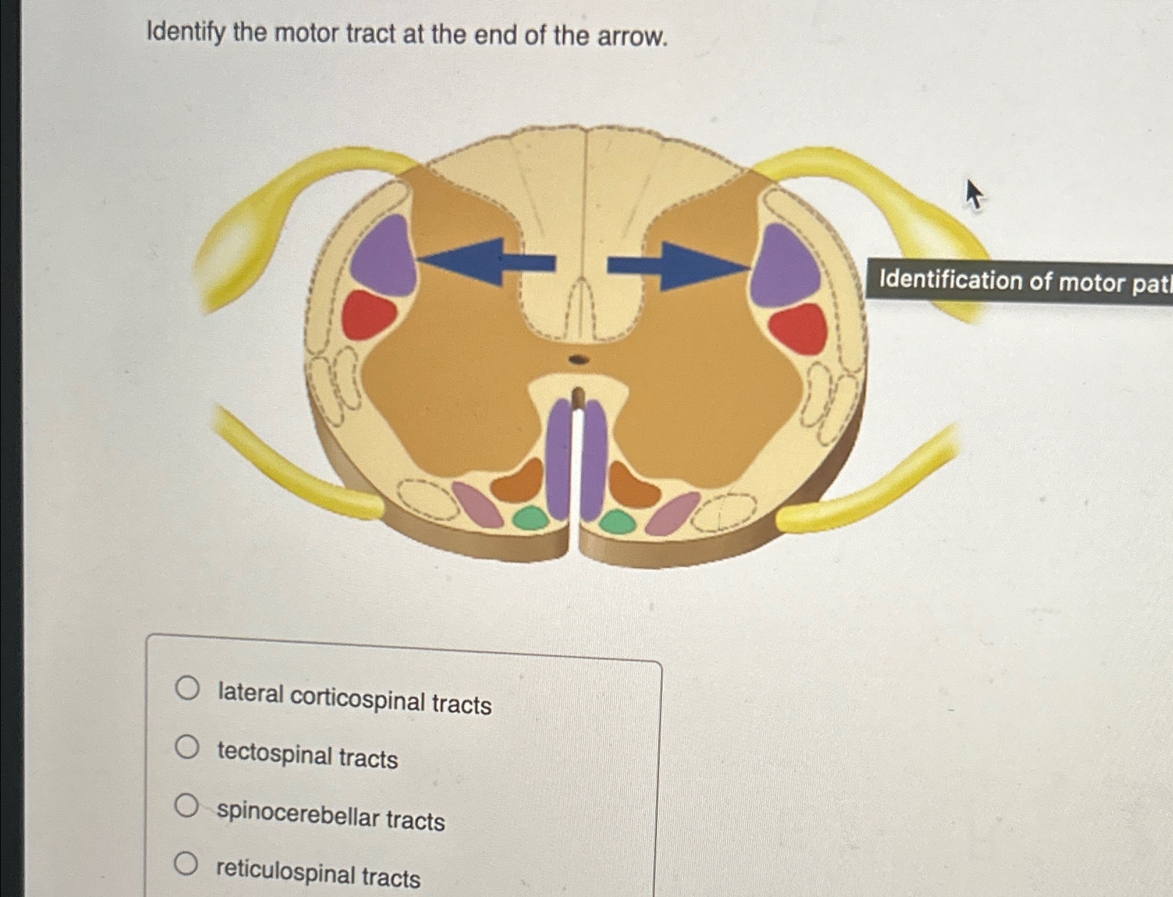 Solved Identify the motor tract at the end of the | Chegg.com