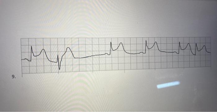 Solved identify the QRS, QT, heart rate and PR, ST, and | Chegg.com