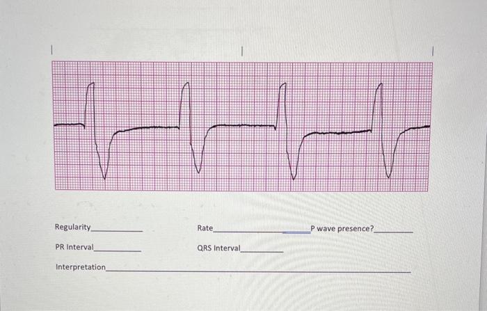 Solved Regularity Rate P wave presence? PR Interval QRS | Chegg.com