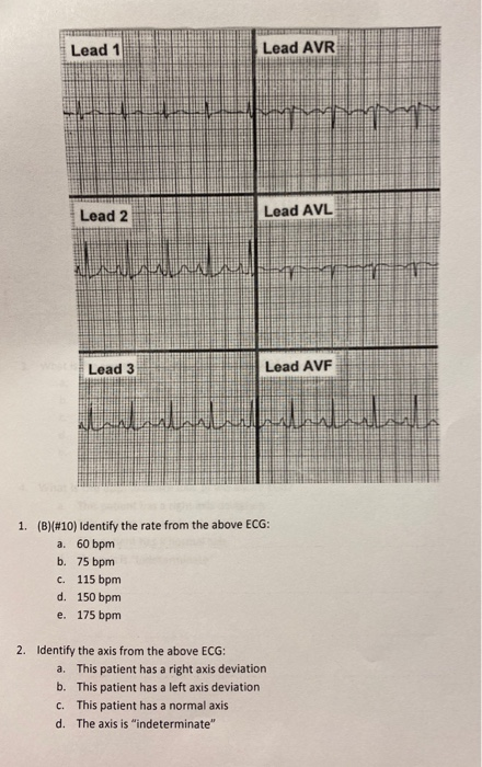 Solved Lead Lead AVR Lead 2 Lead AVL Lead 3 Lead AVF 1. | Chegg.com