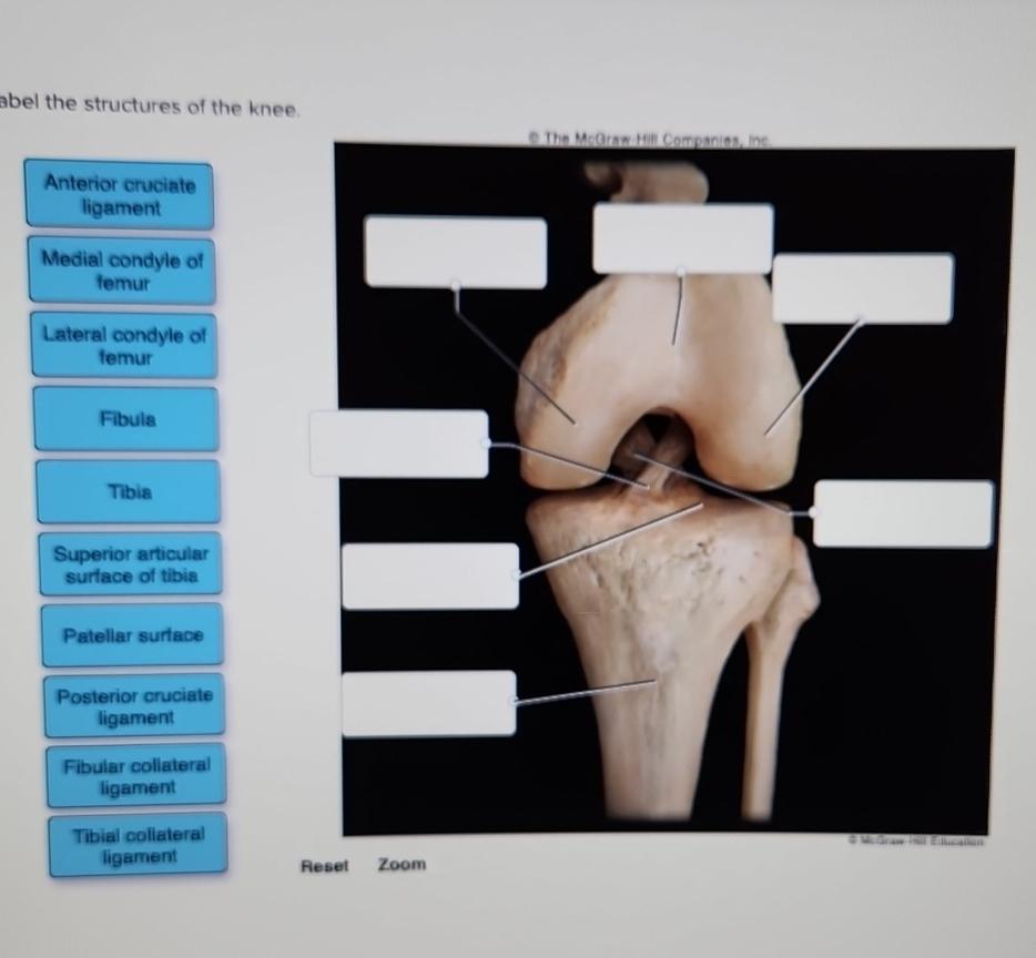 Solved abel the structures of the knee. | Chegg.com