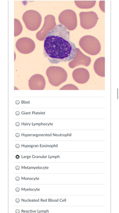 Solved Blast Giant Platelet Hairy Lymphocyte Hypersegmented | Chegg.com