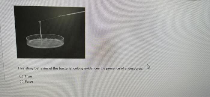 Solved This slimy behavior of the bacterial colony evidences | Chegg.com