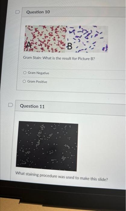 Solved Name the organism (parasite) seen under the | Chegg.com