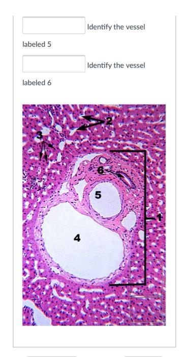 Solved Identify the vessel labeled 5 Identify the vessel | Chegg.com