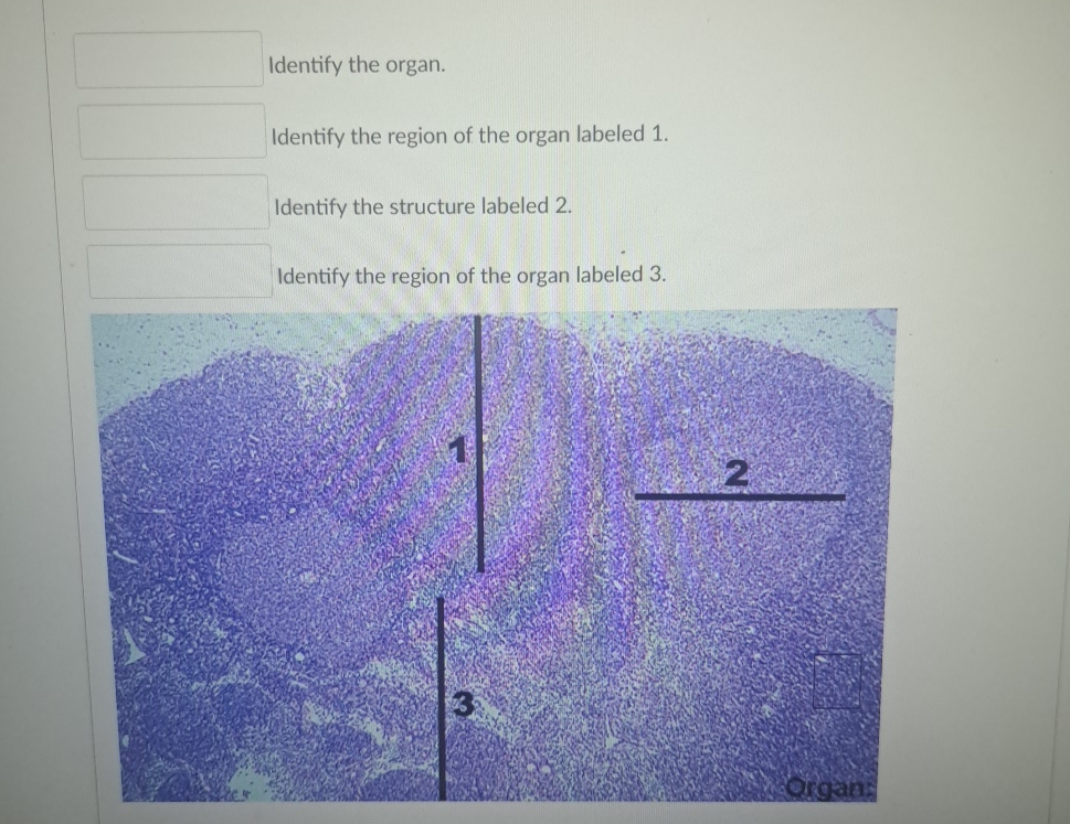 Solved Identify the organ.Identify the region of the organ | Chegg.com Solved Identify the organ.Identify the region of the organ | Chegg.com