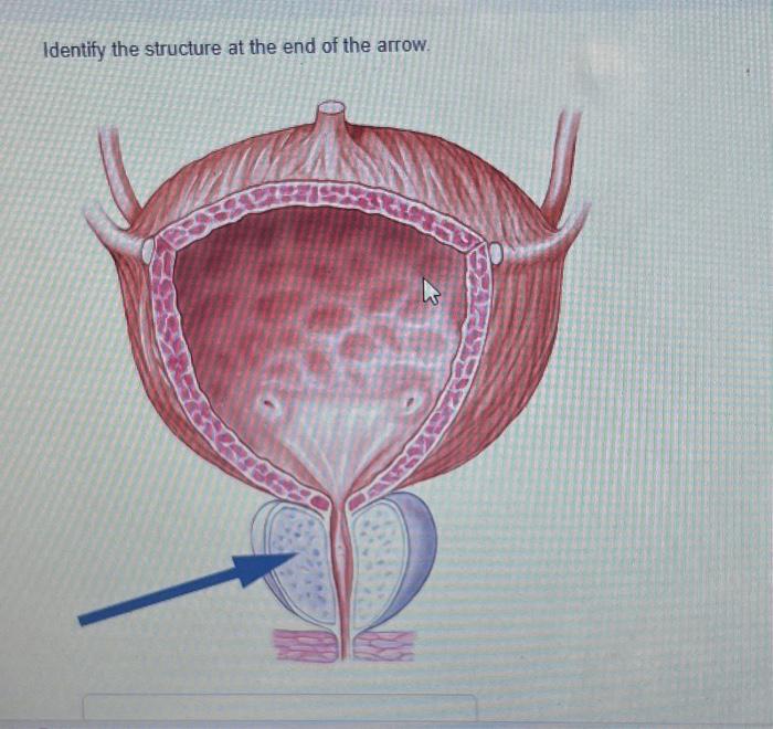 Solved Identify the structure at the end of the arrow. | Chegg.com