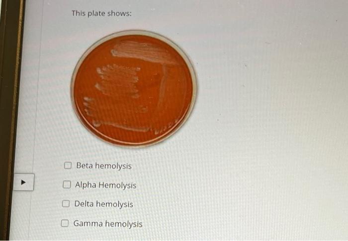 Solved This plate shows: Beta hemolysis Alpha Hemolysis O | Chegg.com