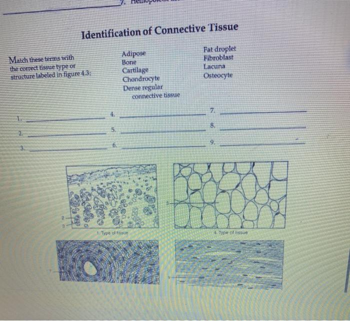 Identification of Connective Tissue Match these terms | Chegg.com