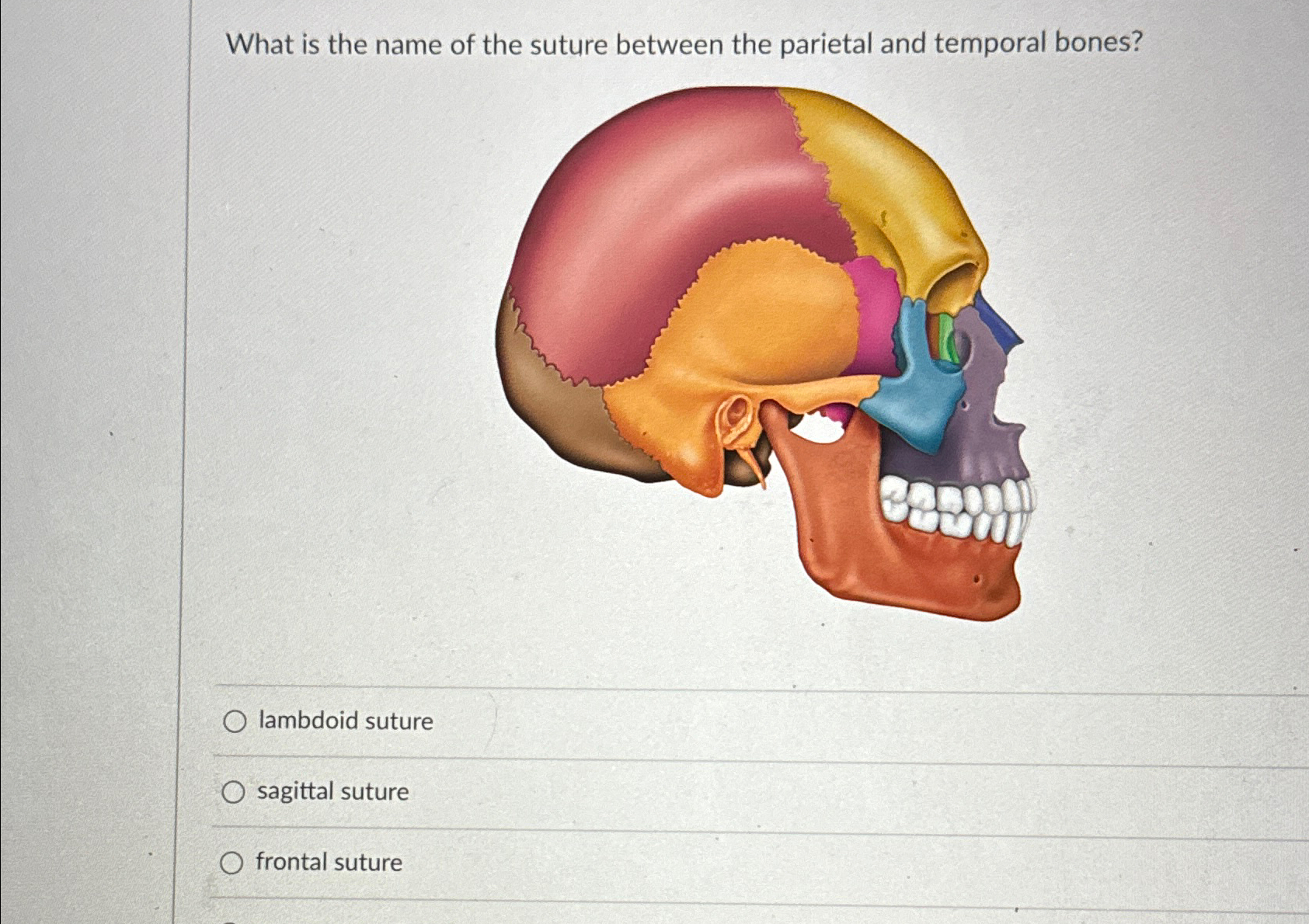 Solved What is the name of the suture between the parietal | Chegg.com