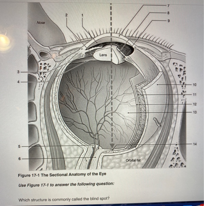 Solved 2 Nose Lens 3 10 11 12 13 14 Orbital fat Figure 17-1 | Chegg.com
