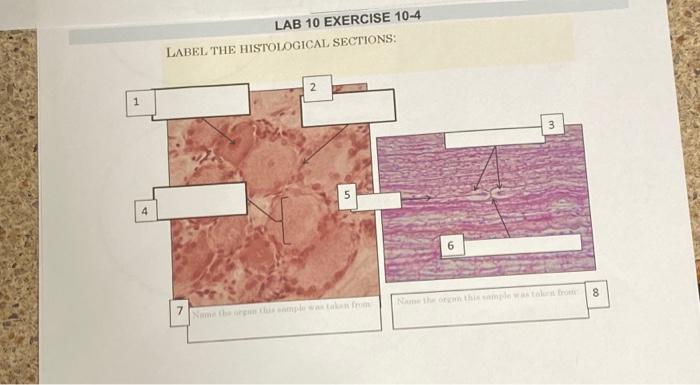 Solved 1 4 LAB 10 EXERCISE 10-4 LABEL THE HISTOLOGICAL | Chegg.com