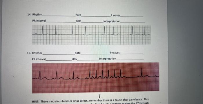 12. Phythm Pate P waves PR interval a9s | Chegg.com