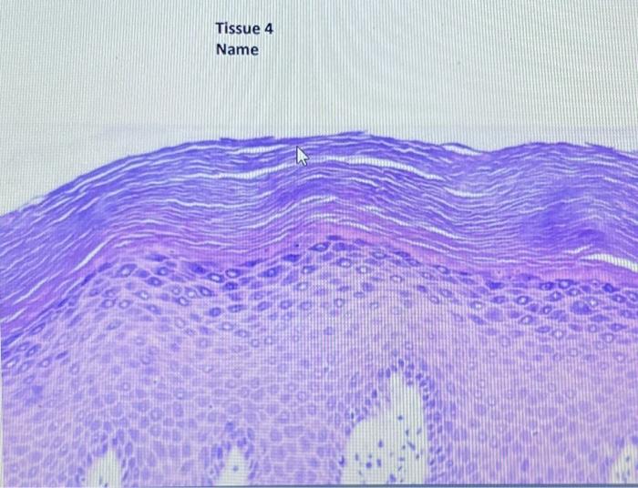 Solved Tissue 5 Name Tissue 4 Name | Chegg.com