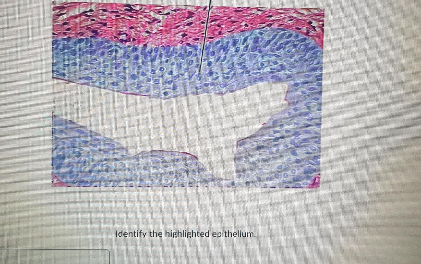 Solved Identify the highlighted epithelium. | Chegg.com