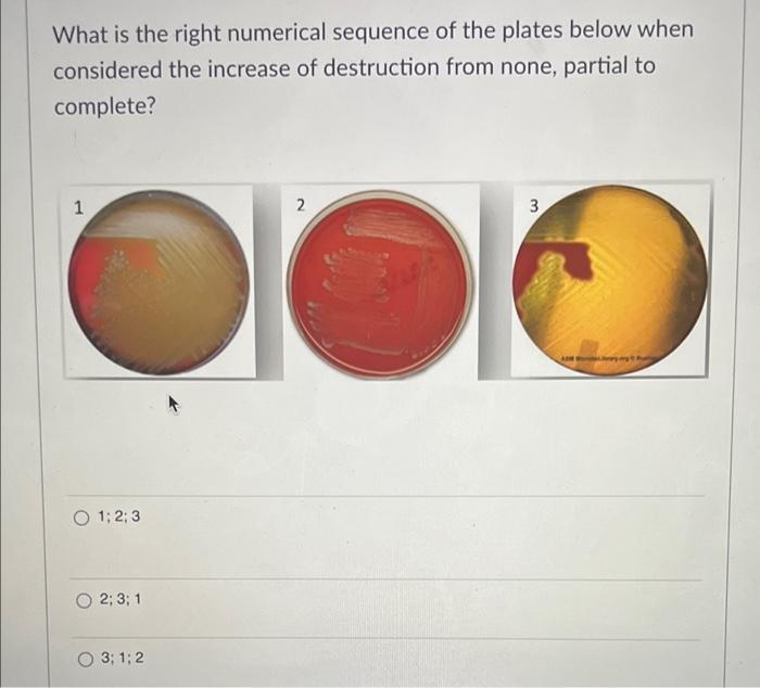 Solved What is the right numerical sequence of the plates | Chegg.com