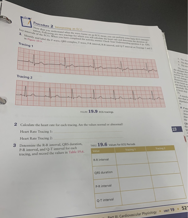 Solved Procedure 1 Correlating Points on an ECG with | Chegg.com