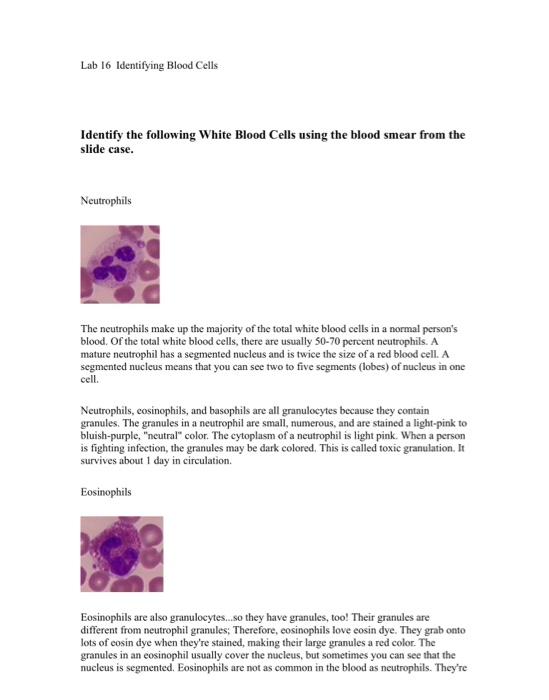 Lab 16 Identifying Blood Cells Identify the following | Chegg.com