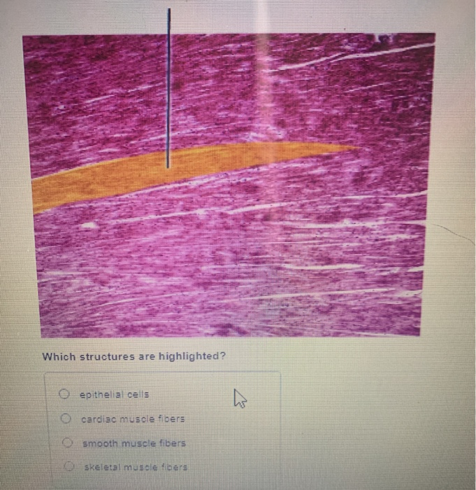 Solved Which structures are highlighted? o epithelial cells | Chegg.com
